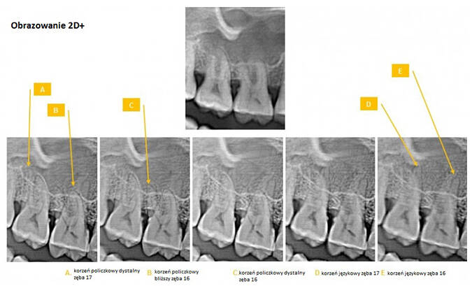 Zdjęcia Panoramiczne Zębów i Rentgen Zębów Łódź